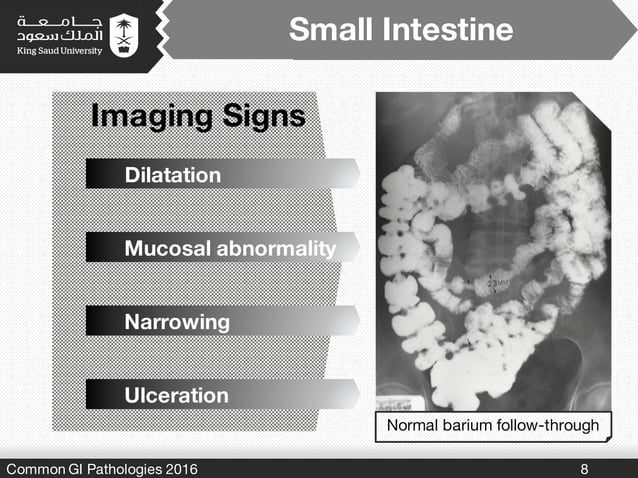 Common GI Pathologies | PDF