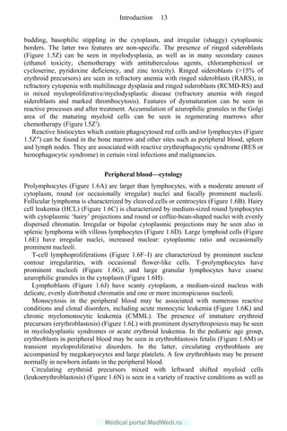 An Atlas Of Differential Diagnosis In Neoplastic Hematopathology ...