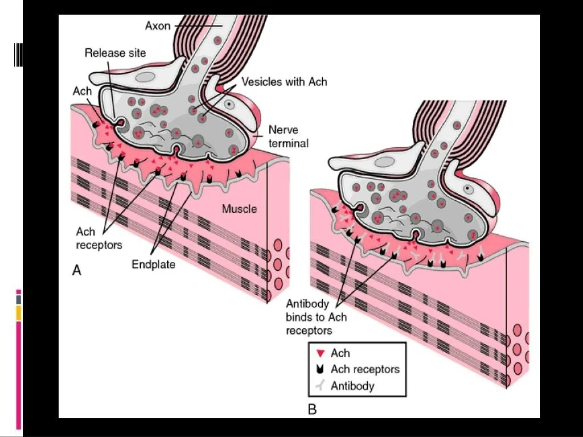 7&8- The Neuromuscular Junction & Physiology of Skeletal Muscle ...