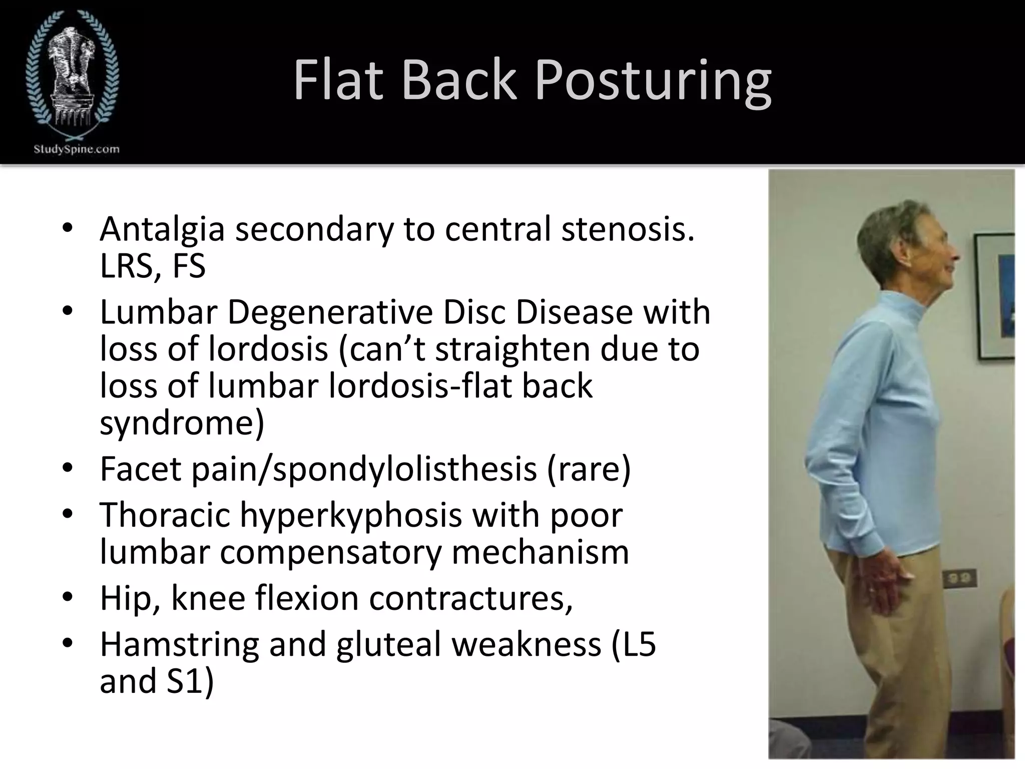 78 year old with flat back posturing | PPTX