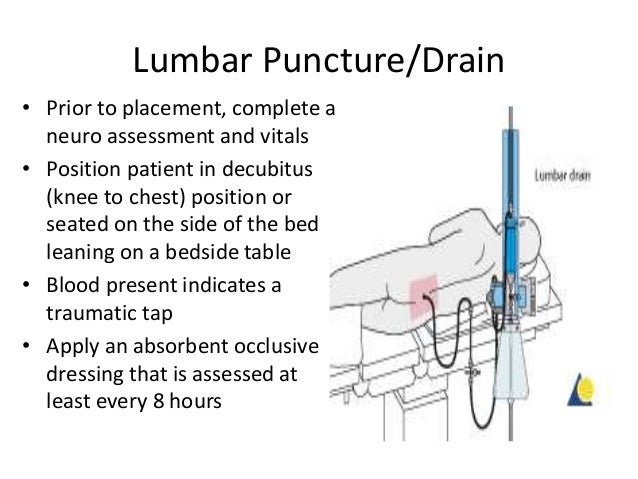 Lumbar Drains