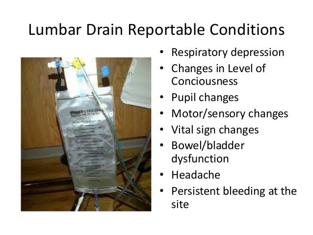 Lumbar Drains