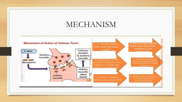 Clostridium tetani (tetanus) - causes, symptoms, diagnosis, treatment ...
