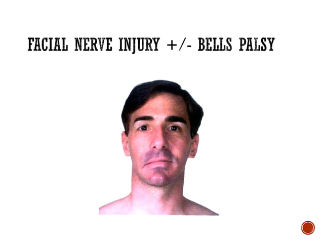 cranial nerves 7 to 12 | PPT