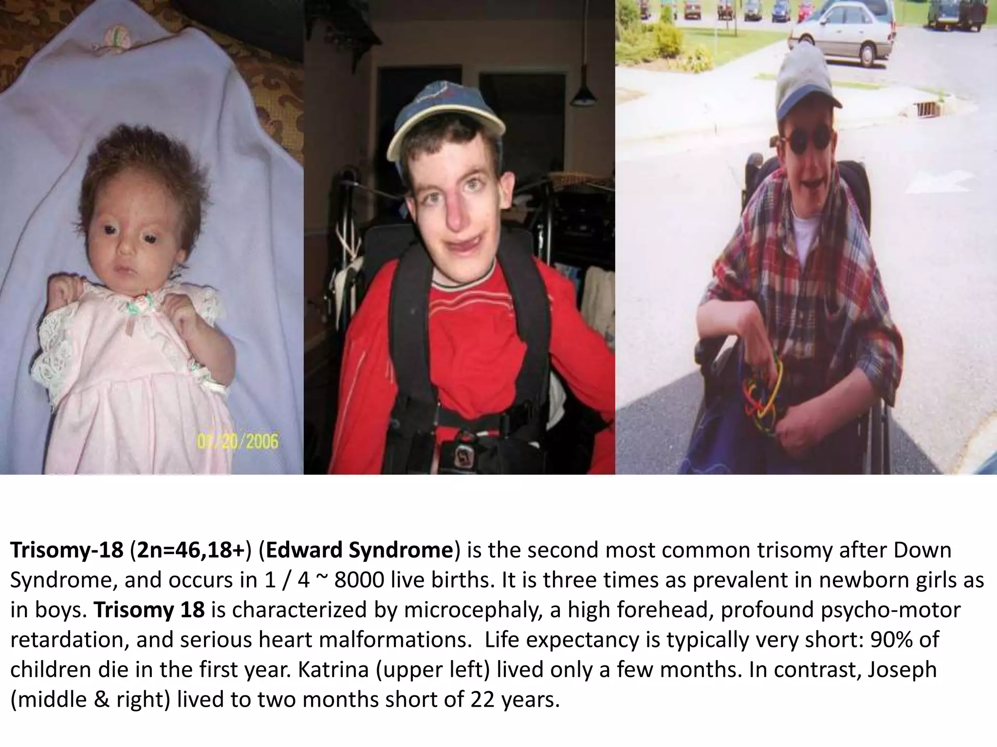 genetics disease chromosome related patho anatomy | PPTX