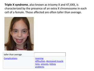 Triple X Syndrome Patient