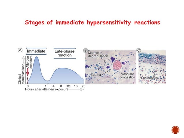 hypersensitivity type 1 | PPT | Allergies | Diseases and Conditions