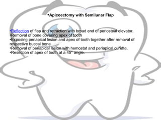 -apicoectomy in teeth with periapical lesions | PPT