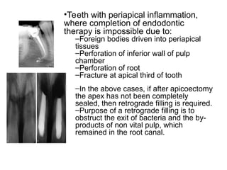 -apicoectomy in teeth with periapical lesions | PPT