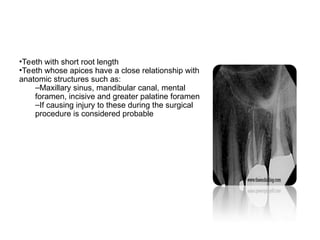 -apicoectomy in teeth with periapical lesions | PPT
