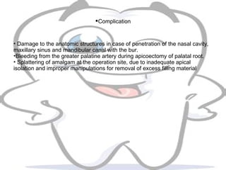 -apicoectomy in teeth with periapical lesions | PPT