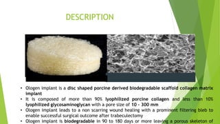 Ologen Implant-Replacing Mmc In Trabeculectomy | PPT