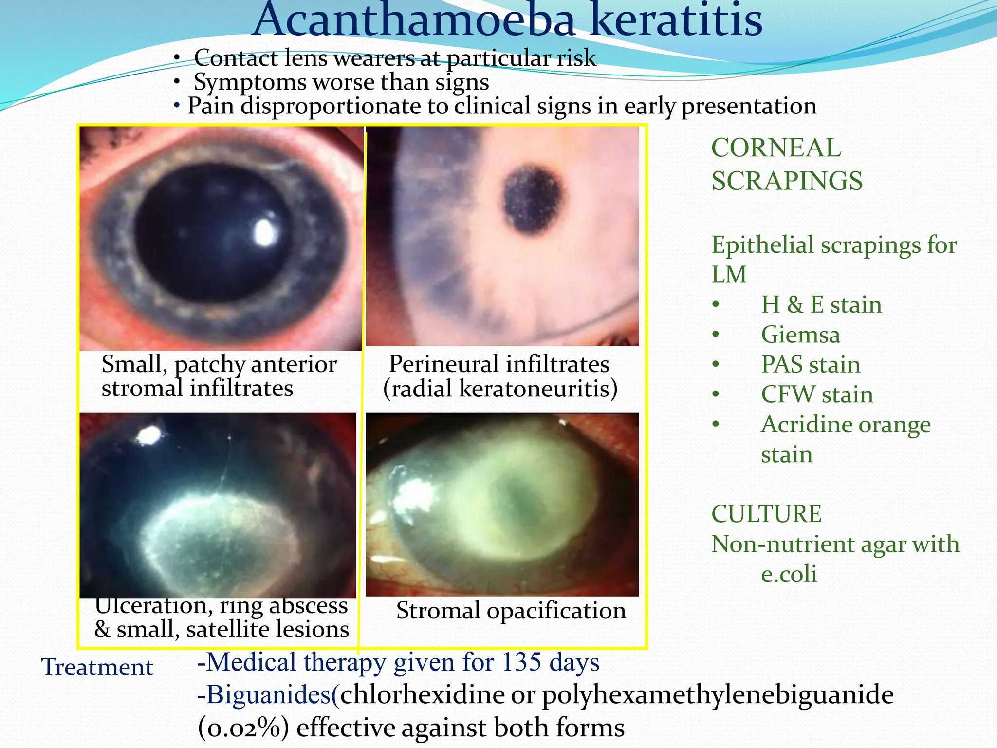 792_Viral__Protozoal_Corneal_Ulcer .pptx
