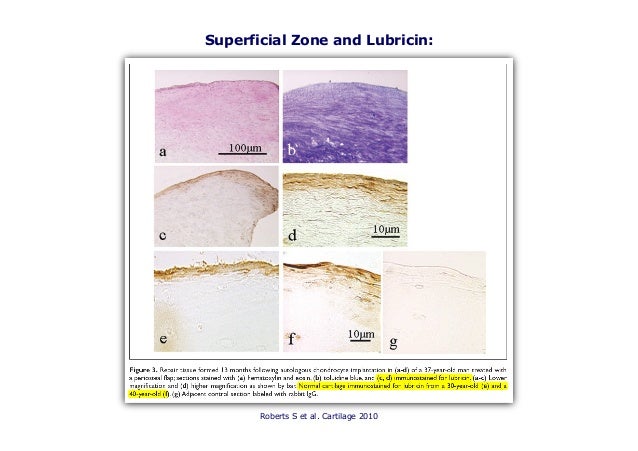 Bobic - Lamina Splendens - Chicago May 2015.pptx