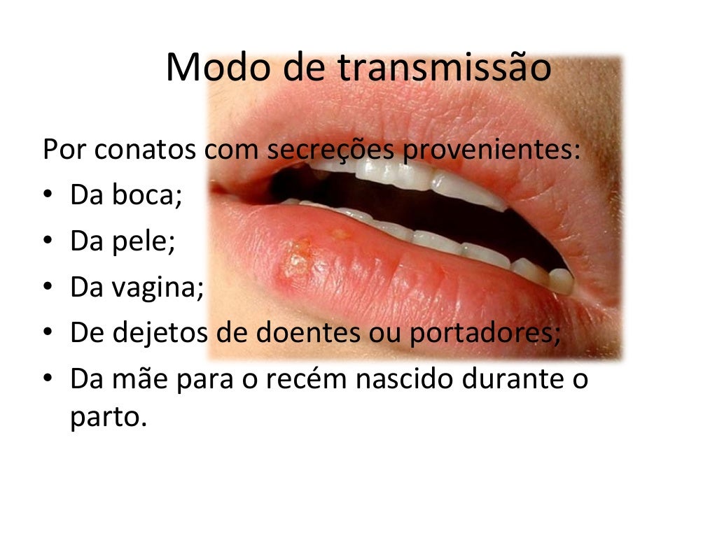 7A - DST e outras doenças