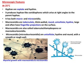 Histoplasmosis and Blastomycosis: Systemic mysosis | PDF