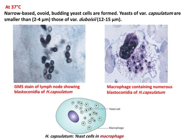Histoplasmosis and Blastomycosis: Systemic mysosis | PDF