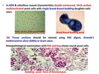 Histoplasmosis and Blastomycosis: Systemic mysosis | PDF