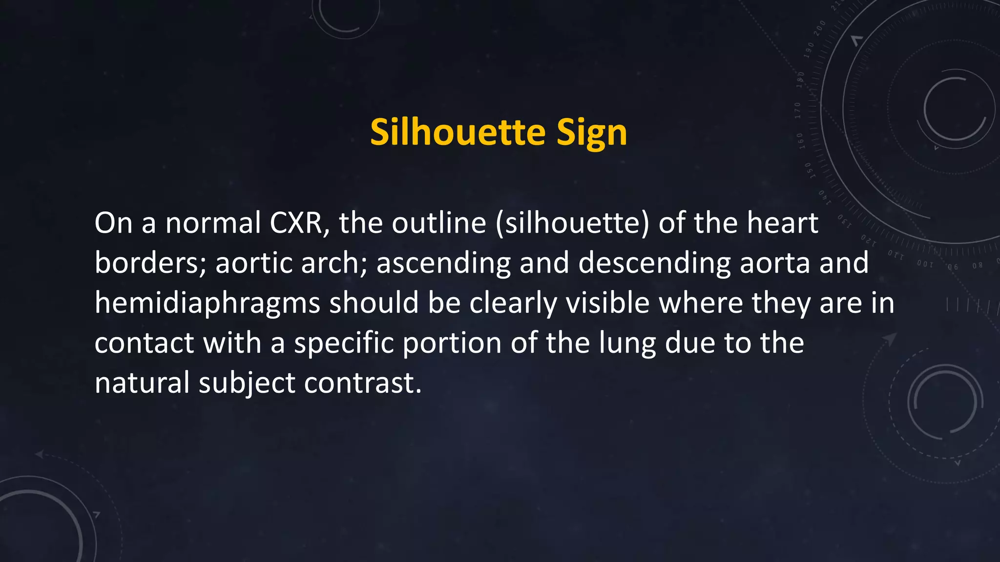 Chest Interpretation Year 3 REVISED | PPTX