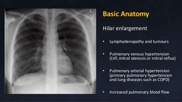 Chest Interpretation Year 3 REVISED