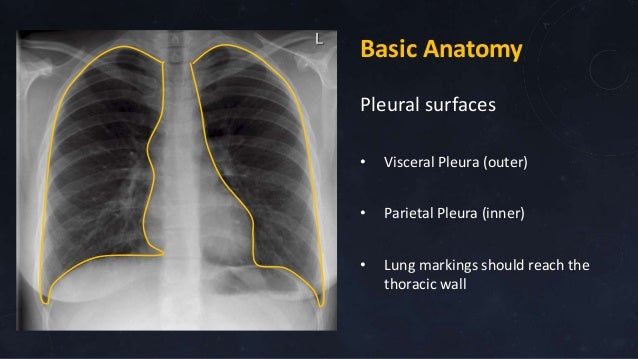 Chest Interpretation Year 3 REVISED