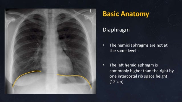 Chest Interpretation Year 3 REVISED