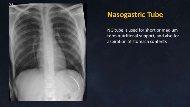Chest Interpretation Year 3 REVISED