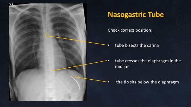 Chest Interpretation Year 3 REVISED
