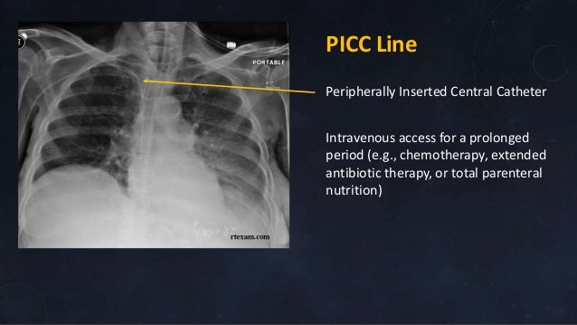 Chest Interpretation Year 3 REVISED