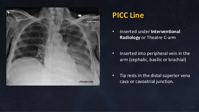 Chest Interpretation Year 3 REVISED