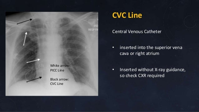 Chest Interpretation Year 3 REVISED