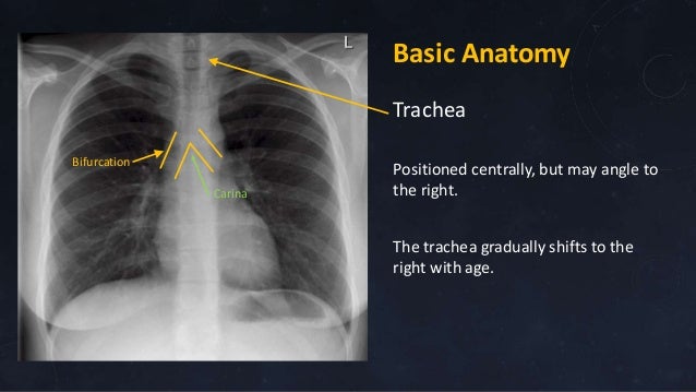 Chest Interpretation Year 3 REVISED