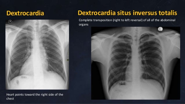 Chest Interpretation Year 3 REVISED