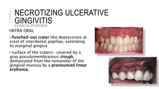 Acute Gingival Infections | PPTX