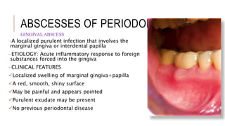 Acute Gingival Infections | PPTX