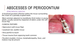 Acute Gingival Infections | PPTX