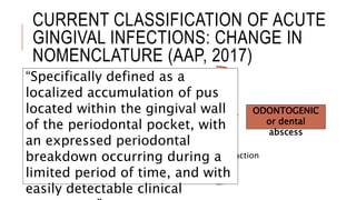 Acute Gingival Infections | PPTX