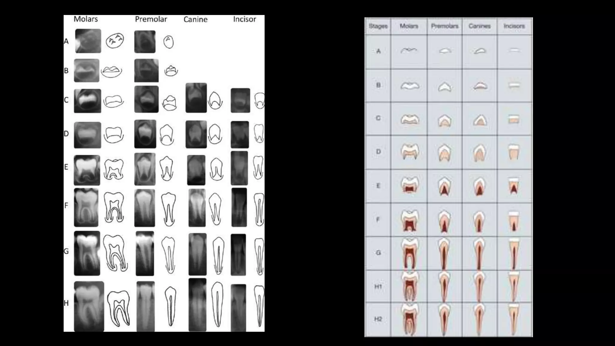 AGE ESTIMATION IN FORENSICS | PPTX