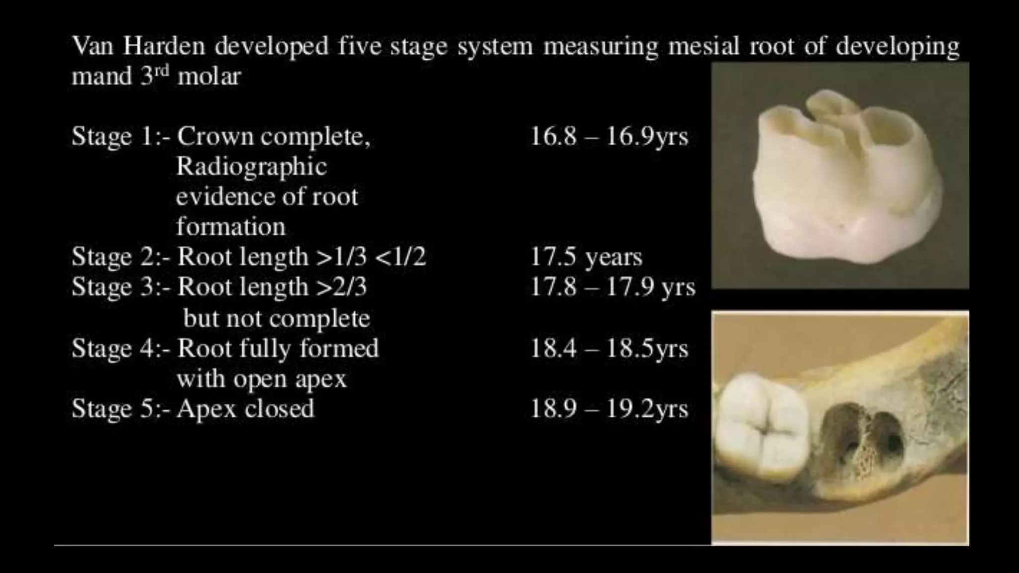AGE ESTIMATION IN FORENSICS | PPTX