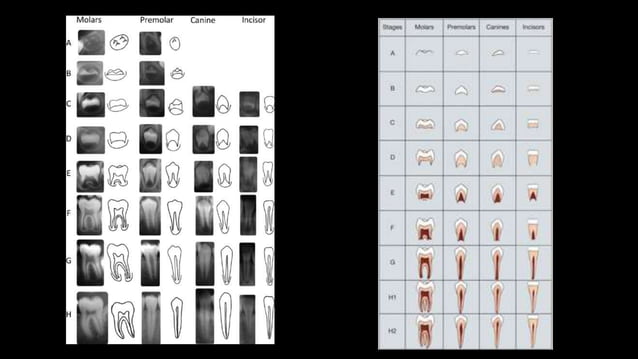 AGE ESTIMATION IN FORENSICS | PPTX | Dental Health | Diseases and ...