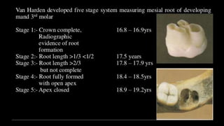 AGE ESTIMATION IN FORENSICS | PPTX