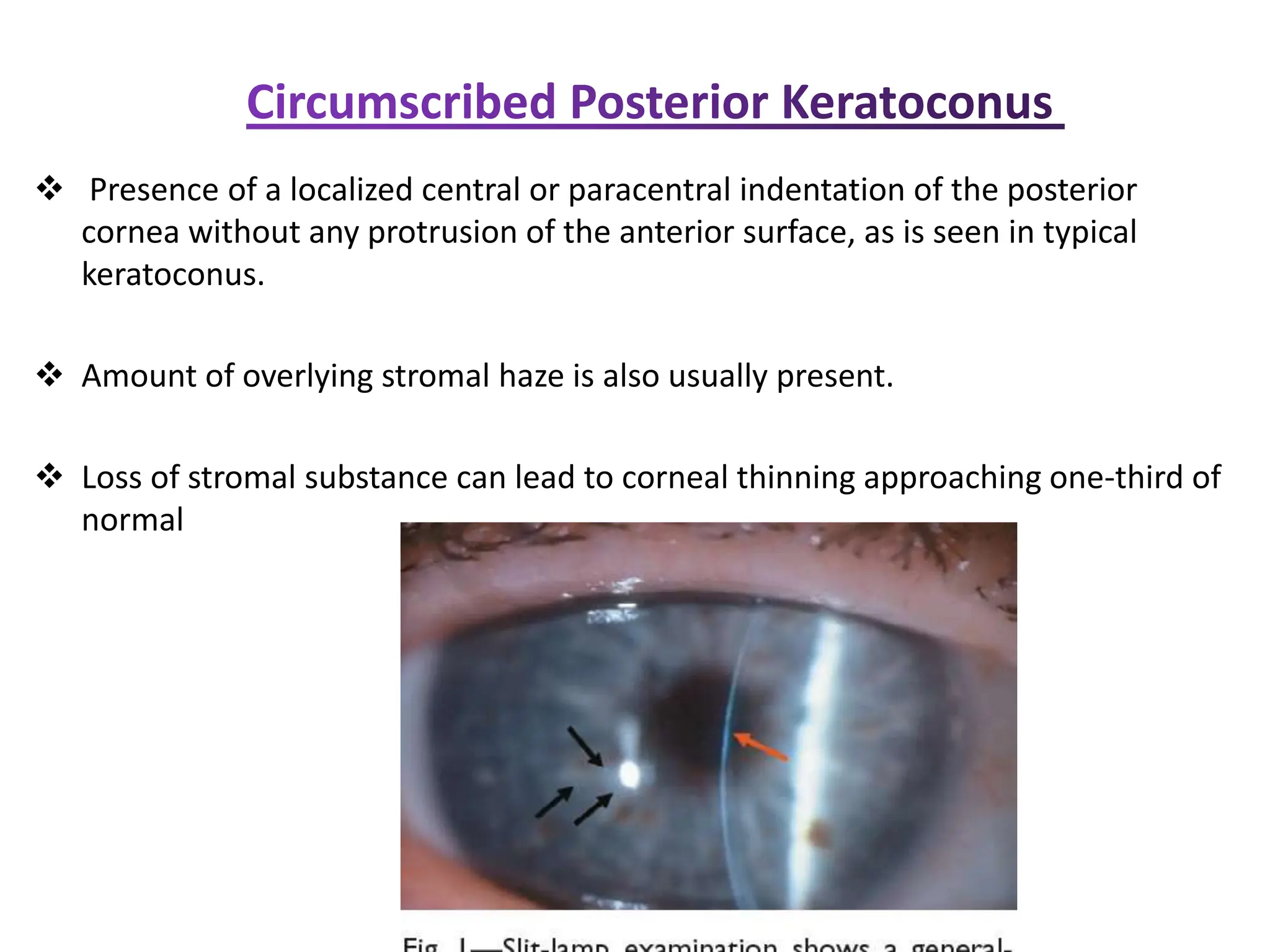 Ophthalmology anatomy of cornea Final.ppt