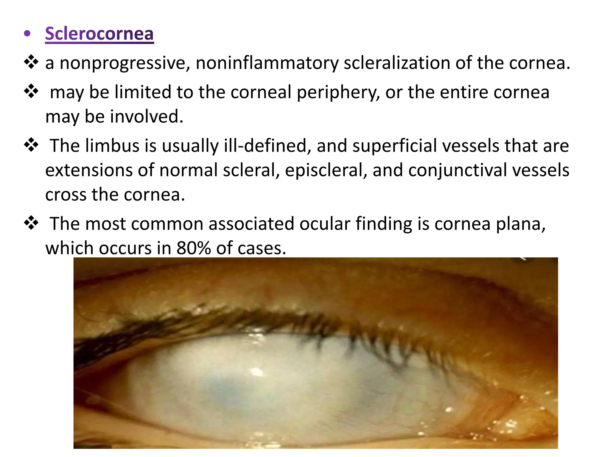 Ophthalmology anatomy of cornea Final.ppt