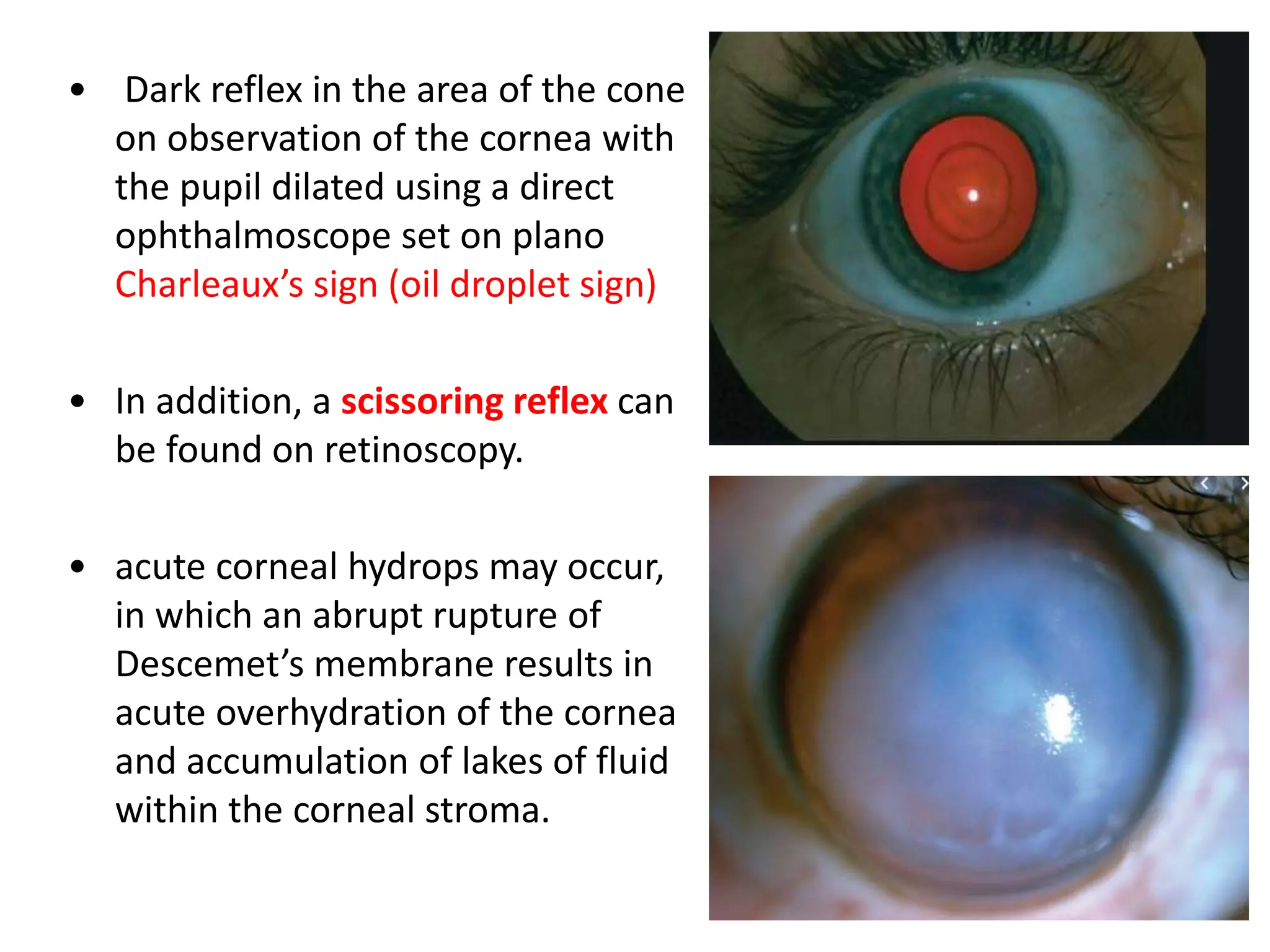 Ophthalmology anatomy of cornea Final.ppt