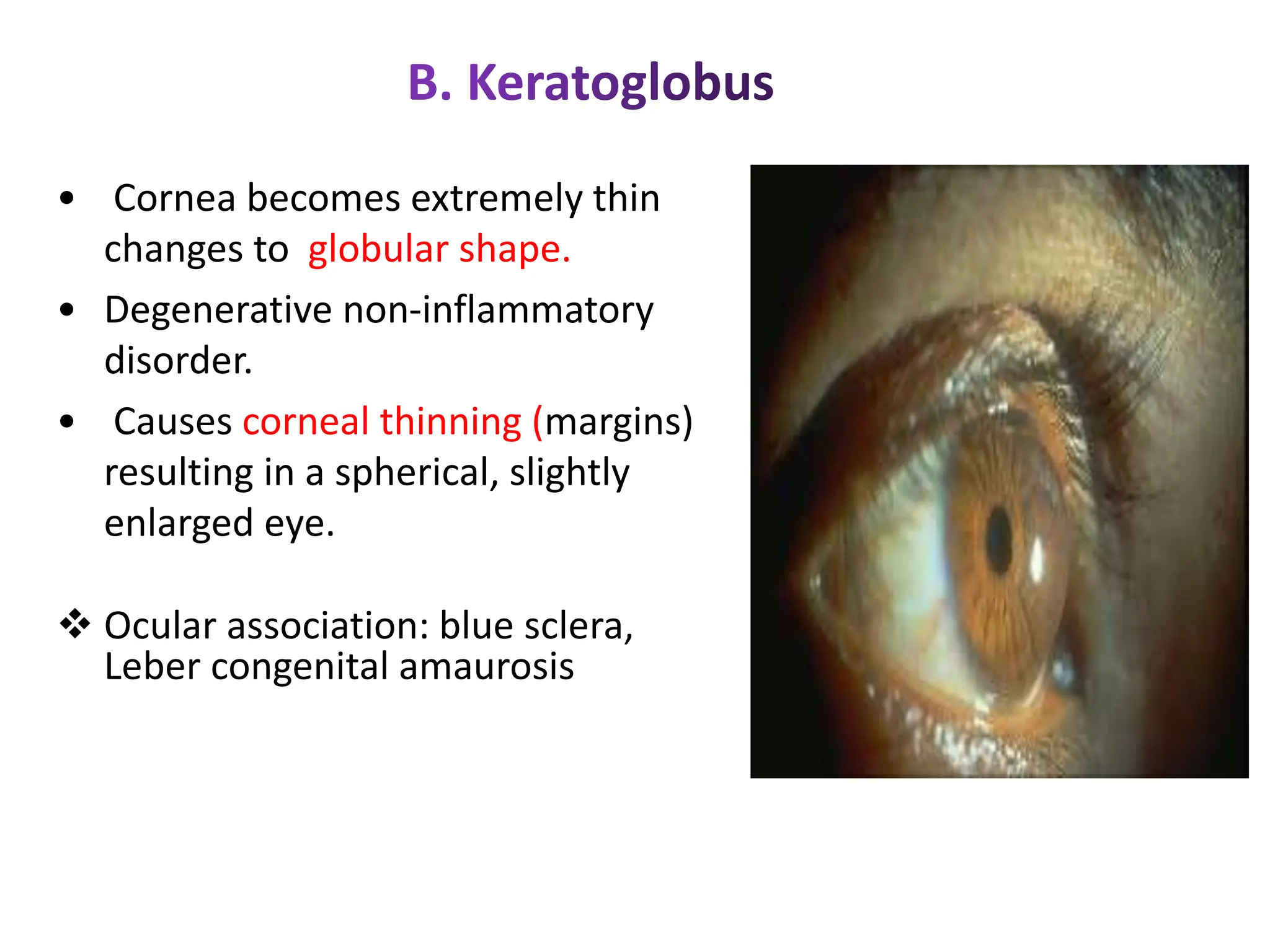 Ophthalmology anatomy of cornea Final.ppt