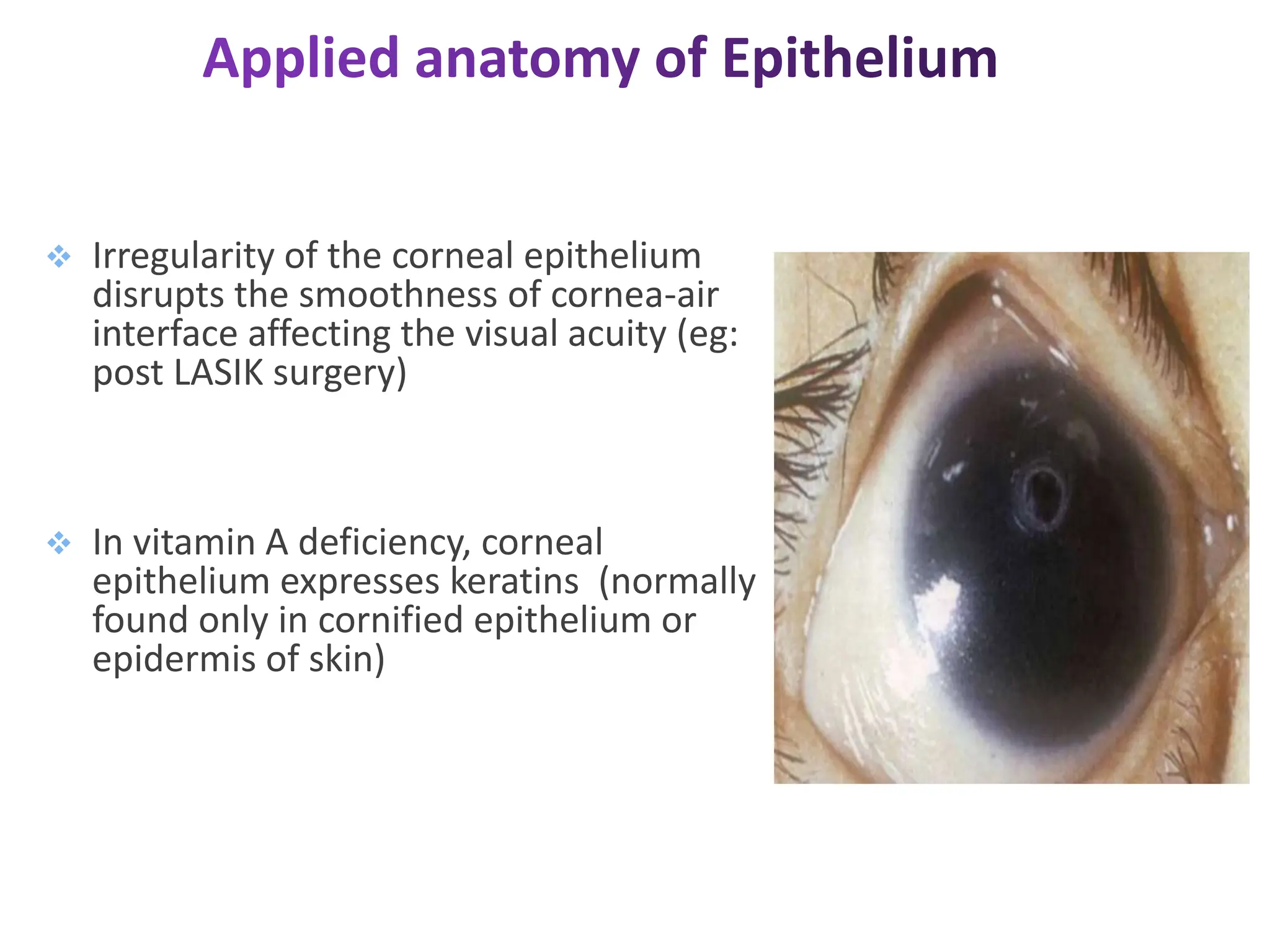 Ophthalmology anatomy of cornea Final.ppt