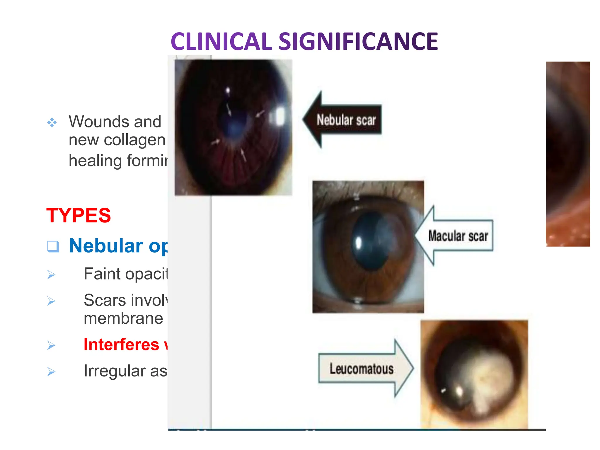 Ophthalmology anatomy of cornea Final.ppt
