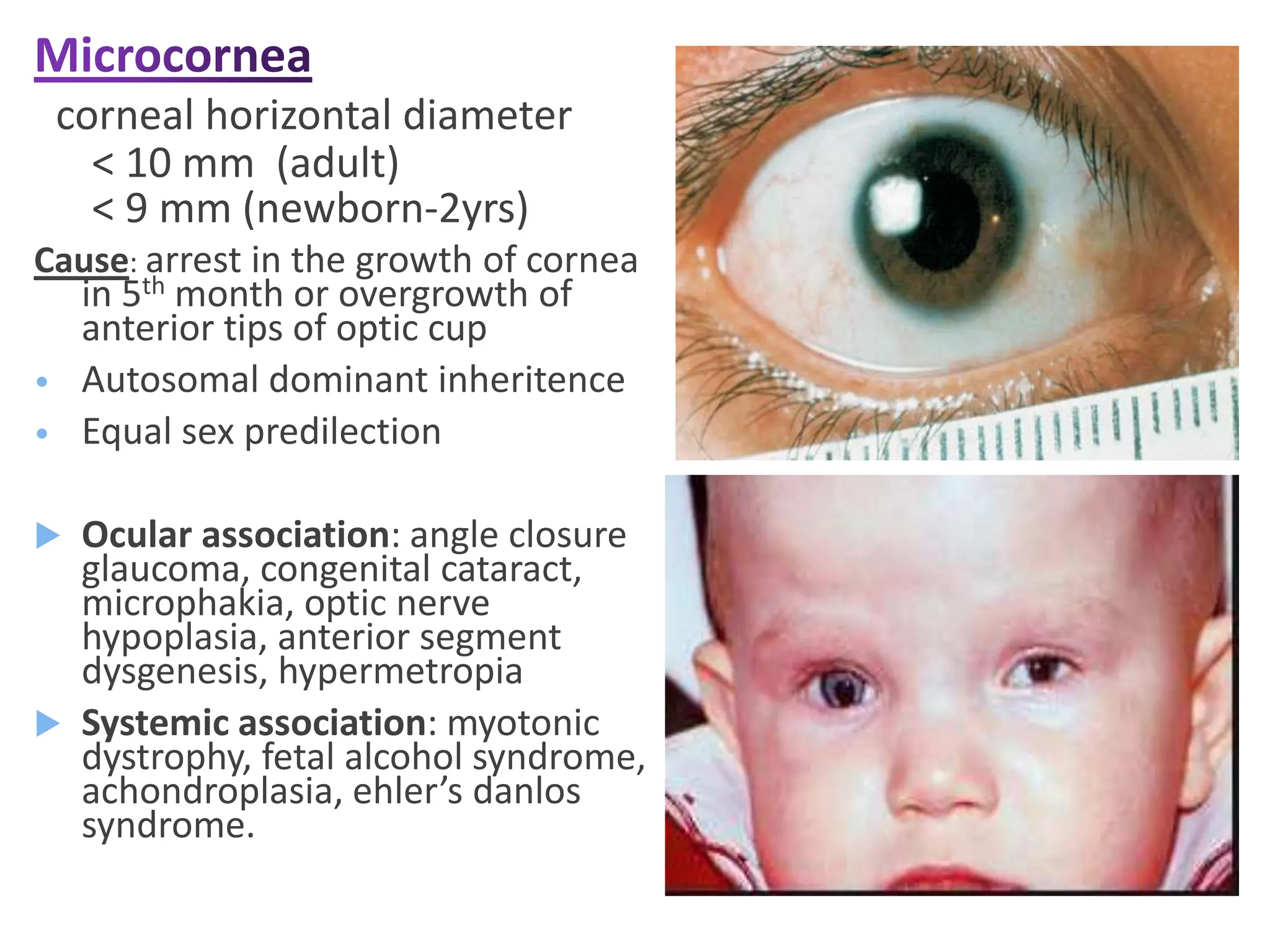 Ophthalmology anatomy of cornea Final.ppt