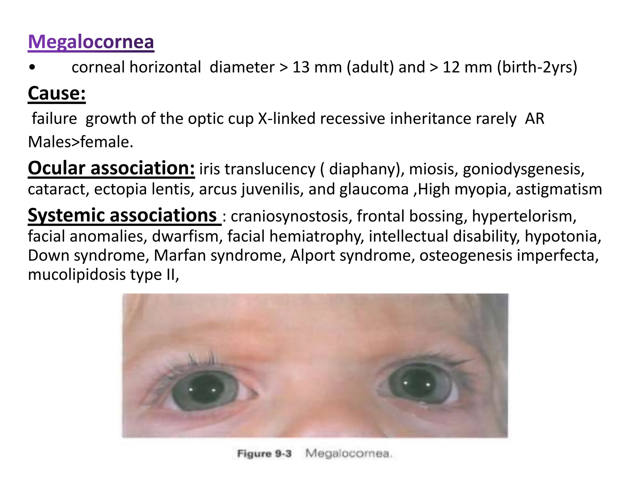 Ophthalmology anatomy of cornea Final.ppt