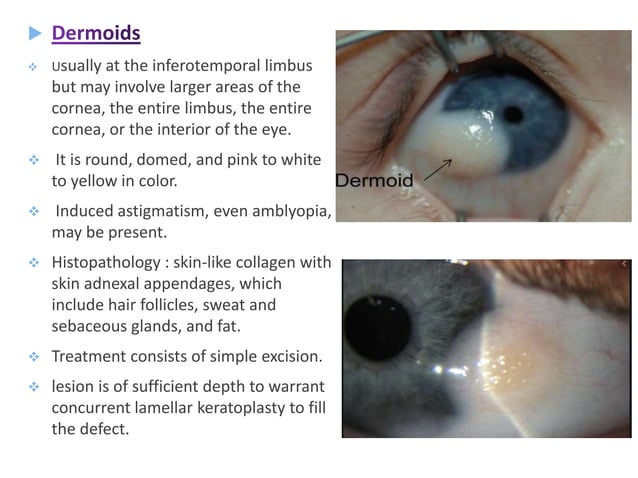 Ophthalmology anatomy of cornea Final.ppt